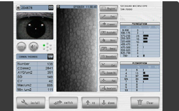 He-7000 China Ophthalmic Equipment Corneal Endothelial Cell Counter
