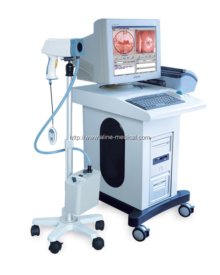 Colposcope Digital Imaging System