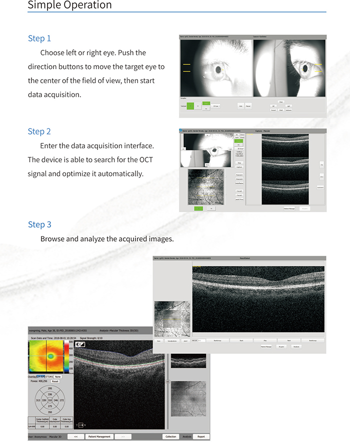 OCT500 Optical Coherence Tomography Ophthalmic Oct